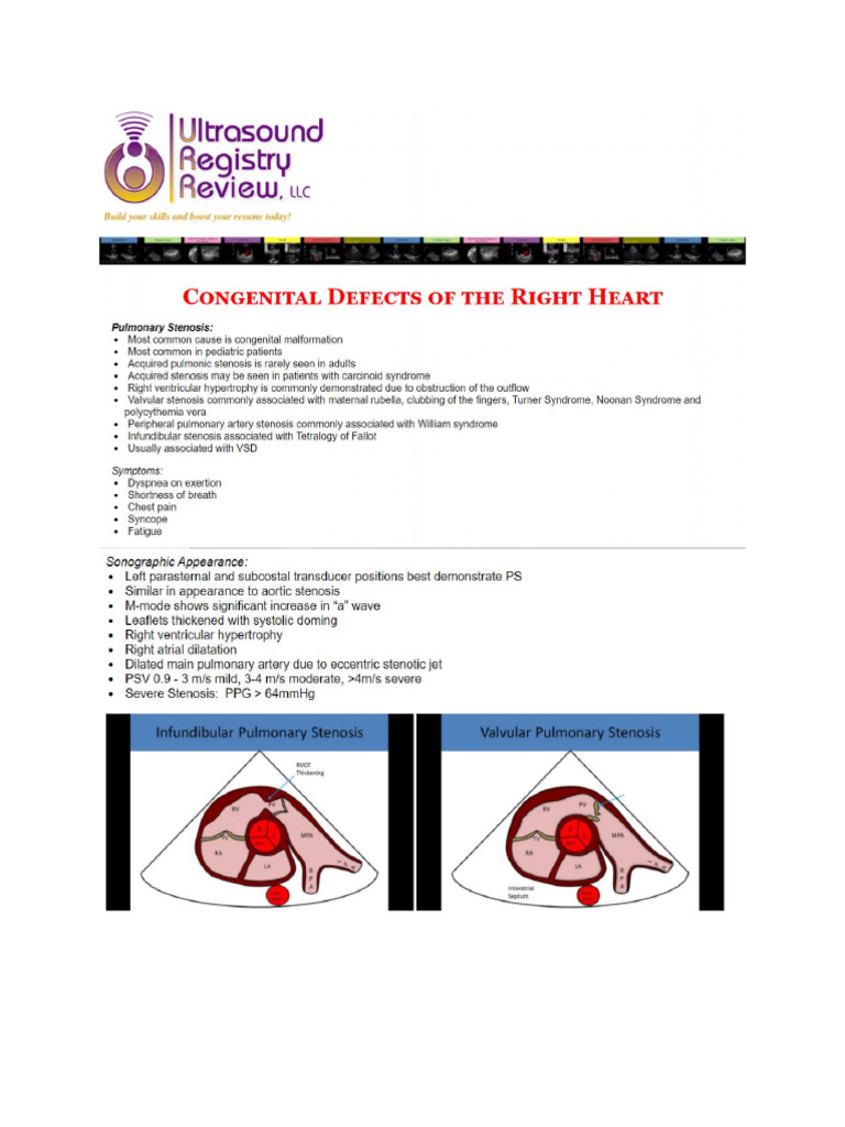USRR Echo Congenital Defects of The Right Heart | PDF