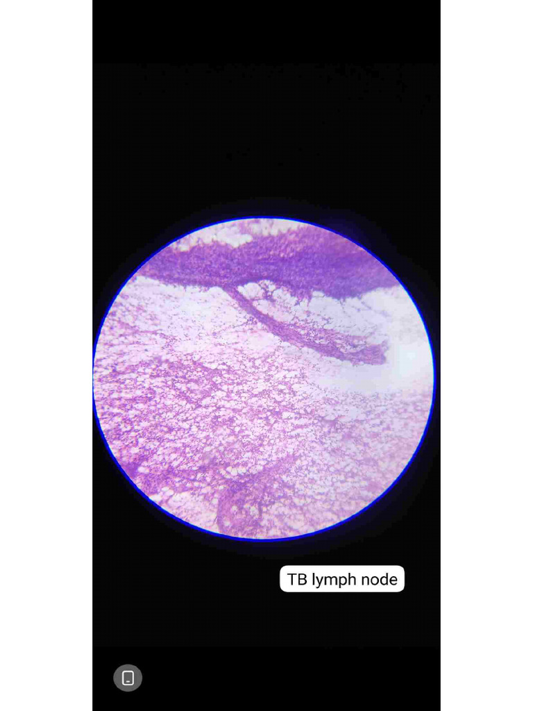 Cytology Slides | PDF