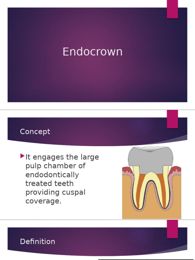 Endocrown: Definition and Preparation Guide | PDF | Dentistry Branches ...