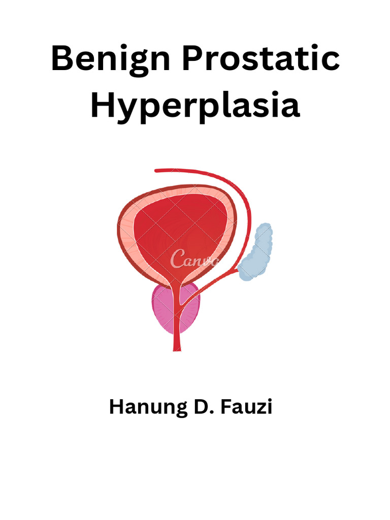 Flip Chart BPH | PDF