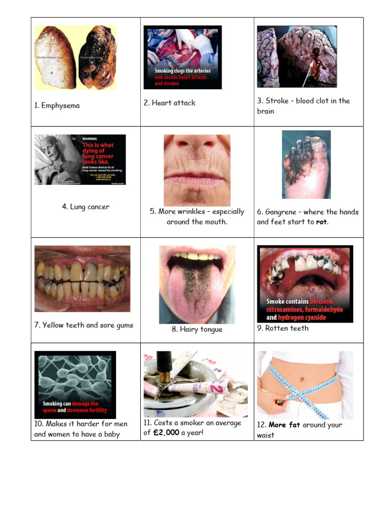 24 Effects of Smoking Card Sorting | PDF