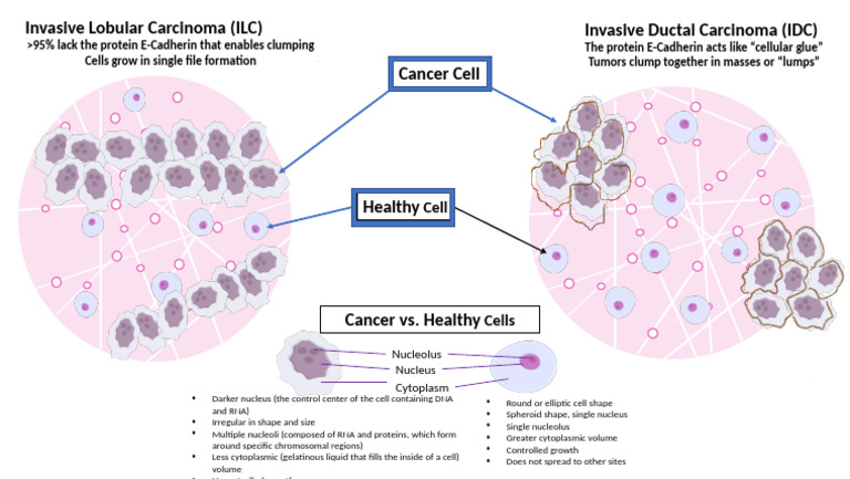 ILC vs. IDC comparison graphic for Maggie (1) | PDF