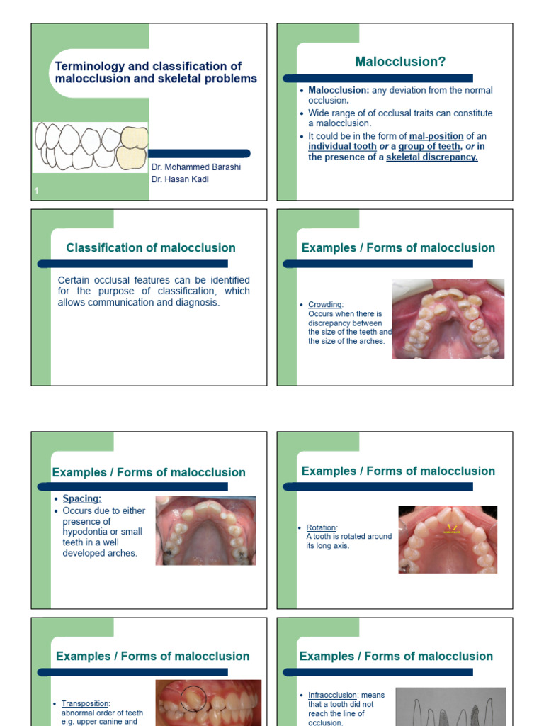 5- classification of malocclusion ??? | PDF | Dentistry | Tooth
