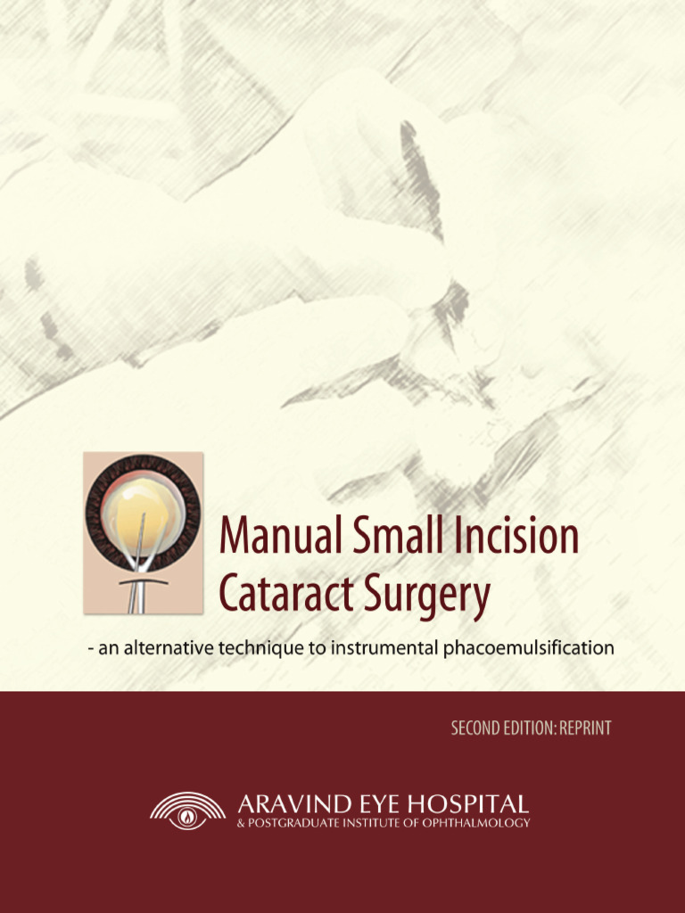 Aravind SICS Manual Cybersight | PDF | Medical Procedures | Eye