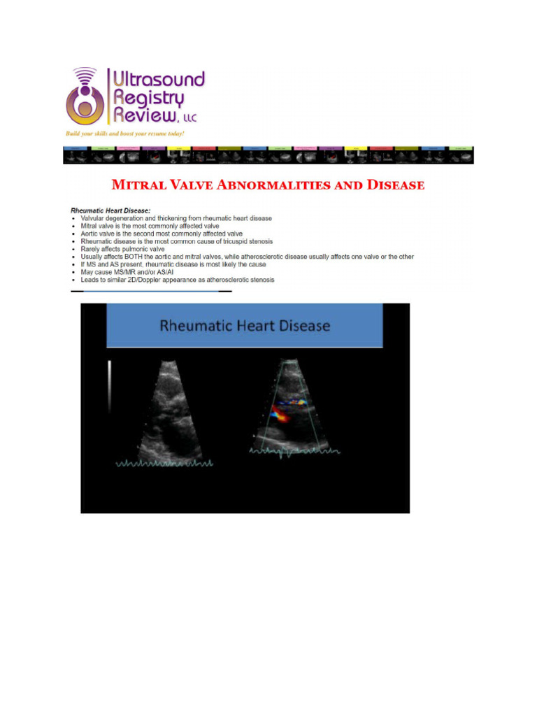 USRR mitral valve disease | PDF