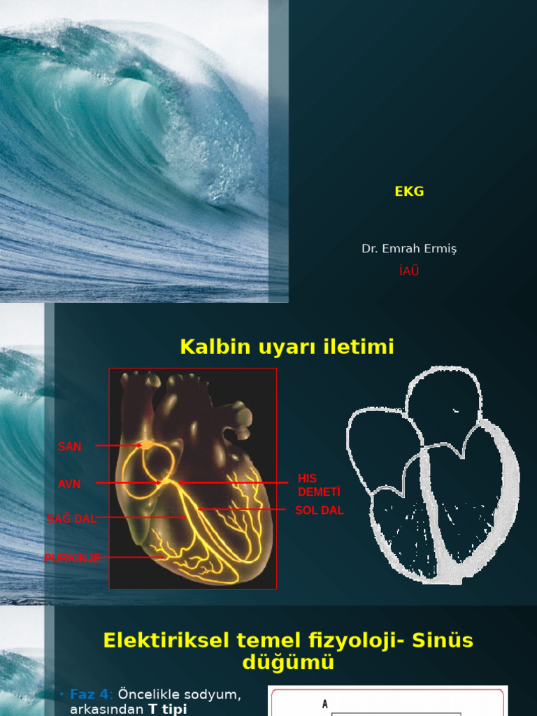 EKG Perikardit Miyokardit KMP | PDF