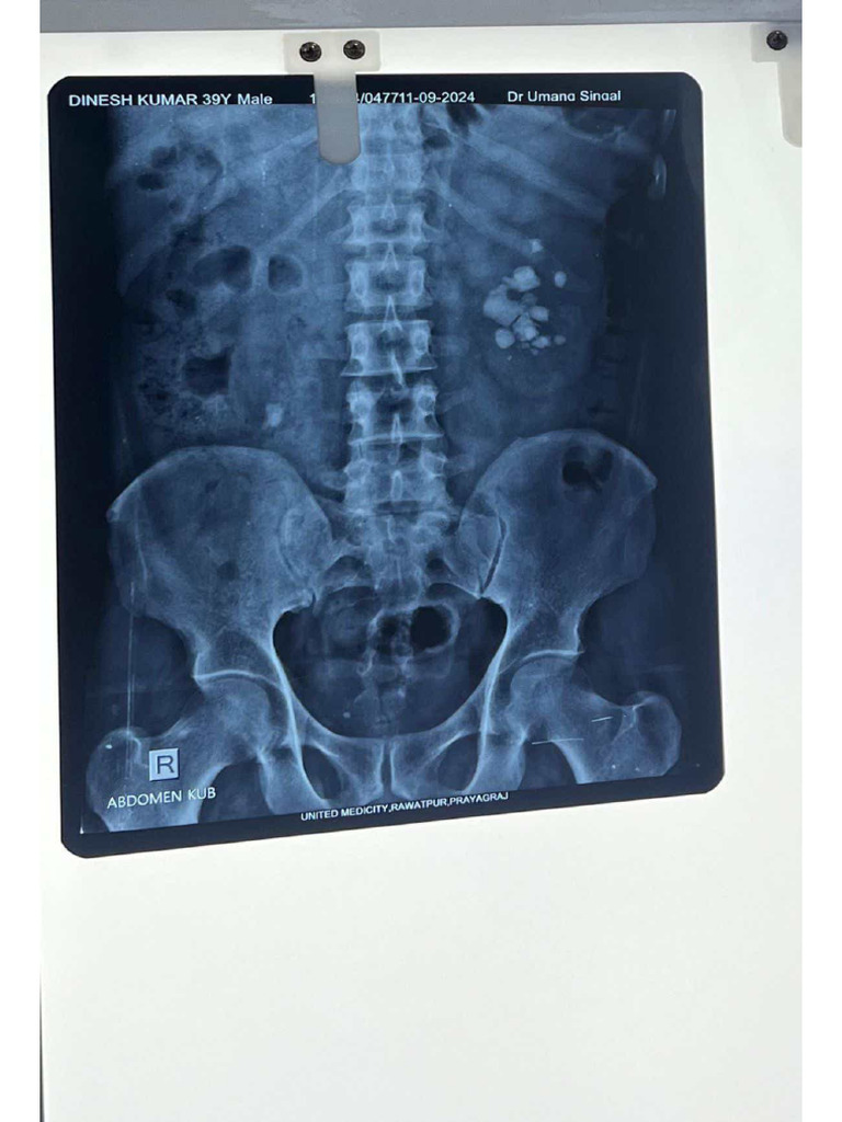Surgery X Ray For Viva | PDF