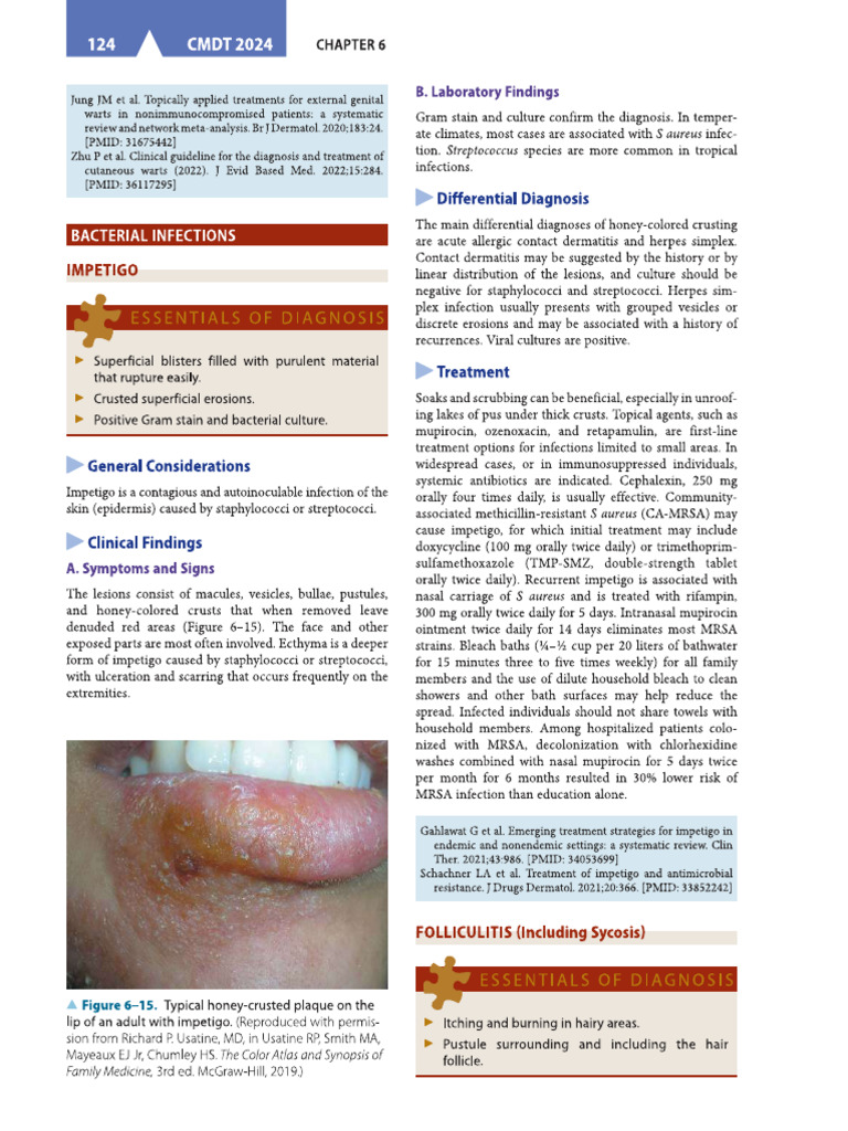 Folliculitis | PDF