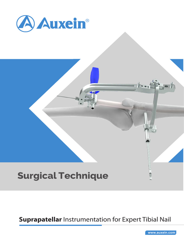 Suprapatellar Tibial Nail Technique Guide | PDF | Knee | Screw
