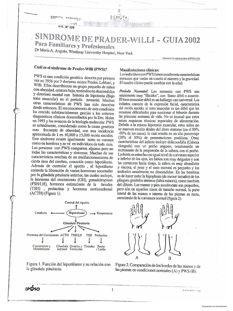 Prader Willi | PDF