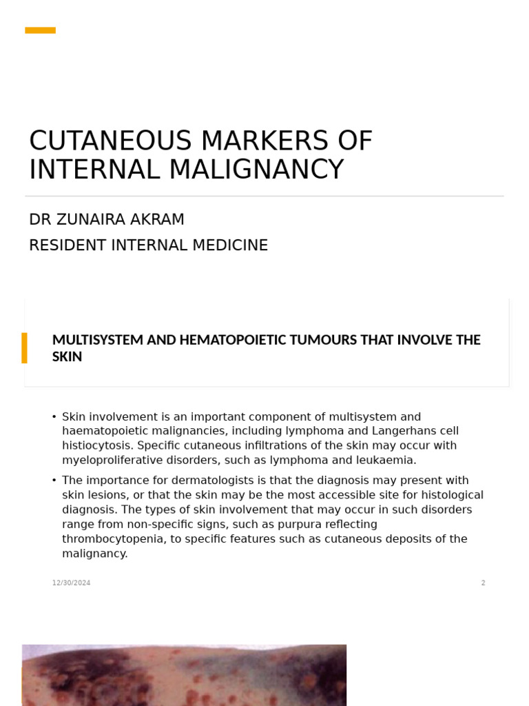 Derma Presentation (1) (1) | PDF | Causes Of Death | Clinical Medicine