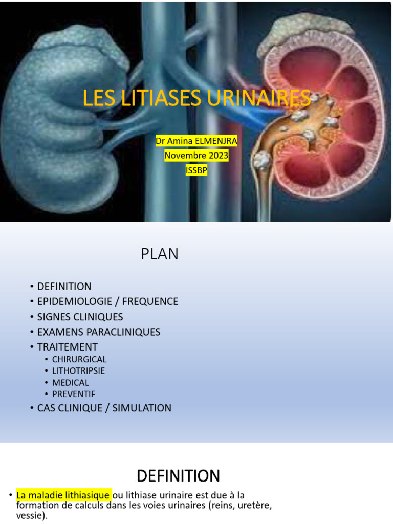 Comprendre la lithiase urinaire : causes et traitements | PDF | Calcium ...