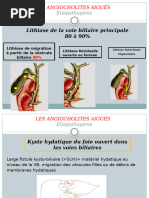 Classification de l'angiocholite aiguë | PDF | Vésicule biliaire ...