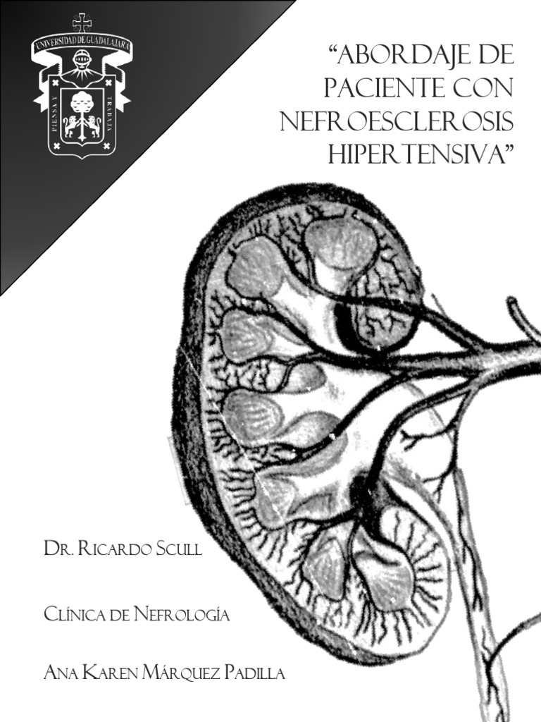 Generalidades Sobre Nefroesclerosis Hipertensiva | PDF | Hipertensión ...