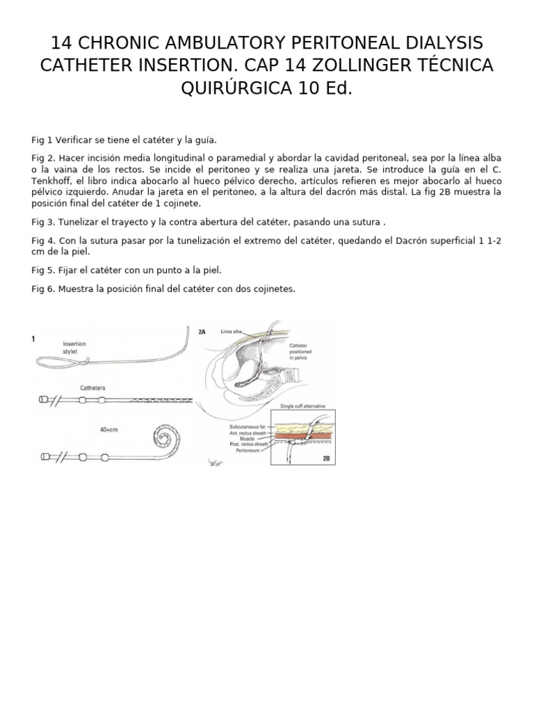 14 CHRONIC AMBULATORY PERITONEAL DIALYSIS CATHETER INSERTION. CAP 14 ZOLLINGER TÉCNICA ...