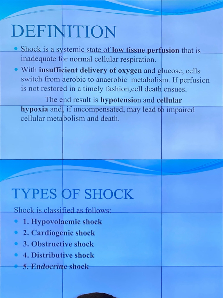 Shock | PDF