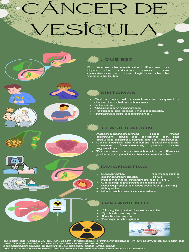 Cáncer de Vesícula | PDF | Cáncer | Neoplasias