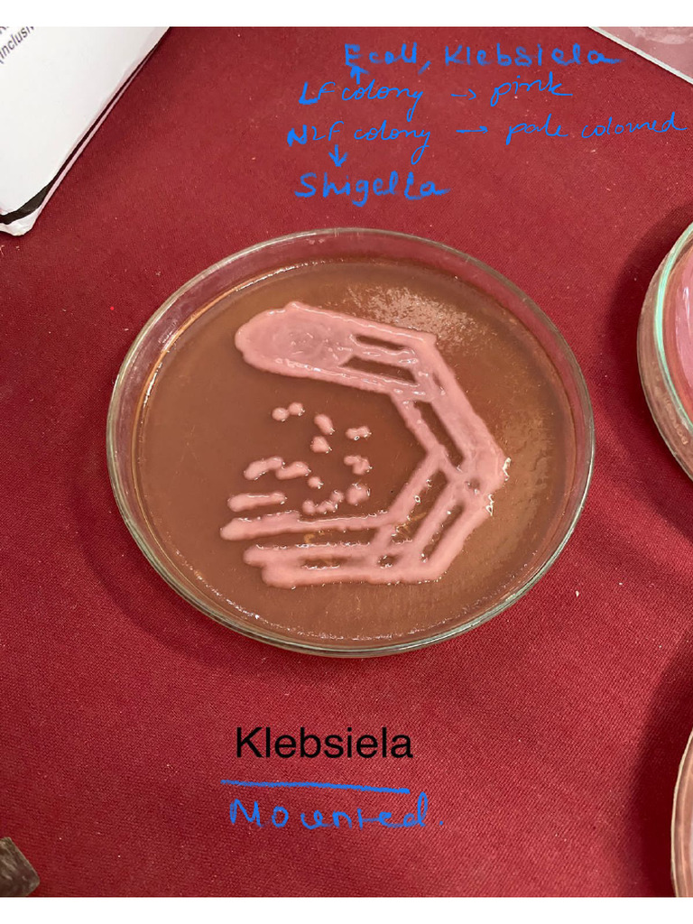 Microbiology Practical | PDF