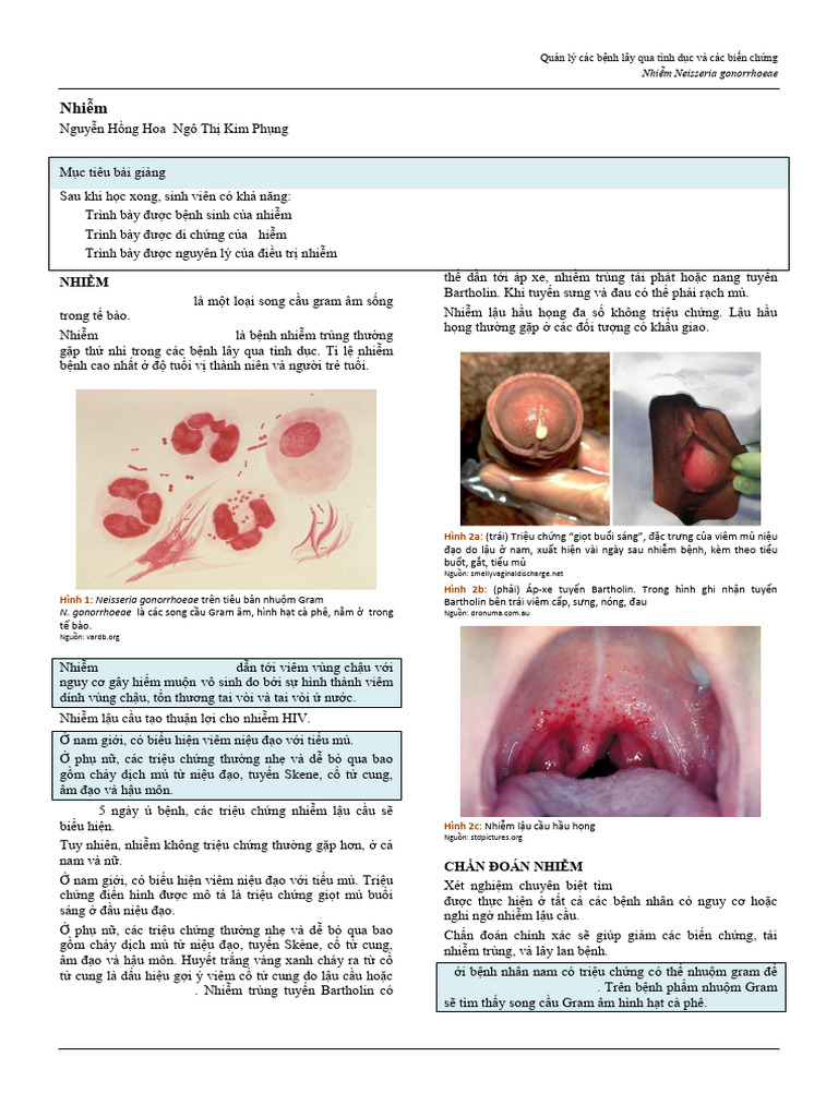 Nhiem_Neisseria_gonorrhoeae | PDF