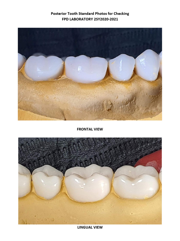 FPD Sample Photographs | PDF