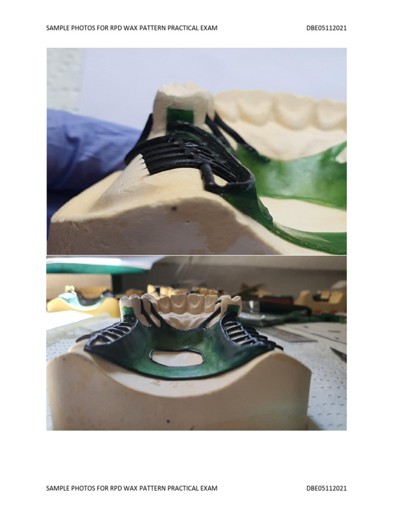 RPD-Sample-Photographs(2) | PDF