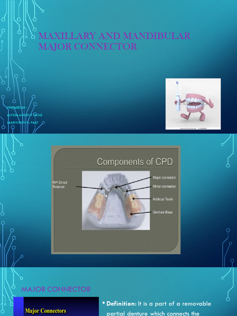Maxillary and Mandibular Major Connector | PDF | Dentistry Branches