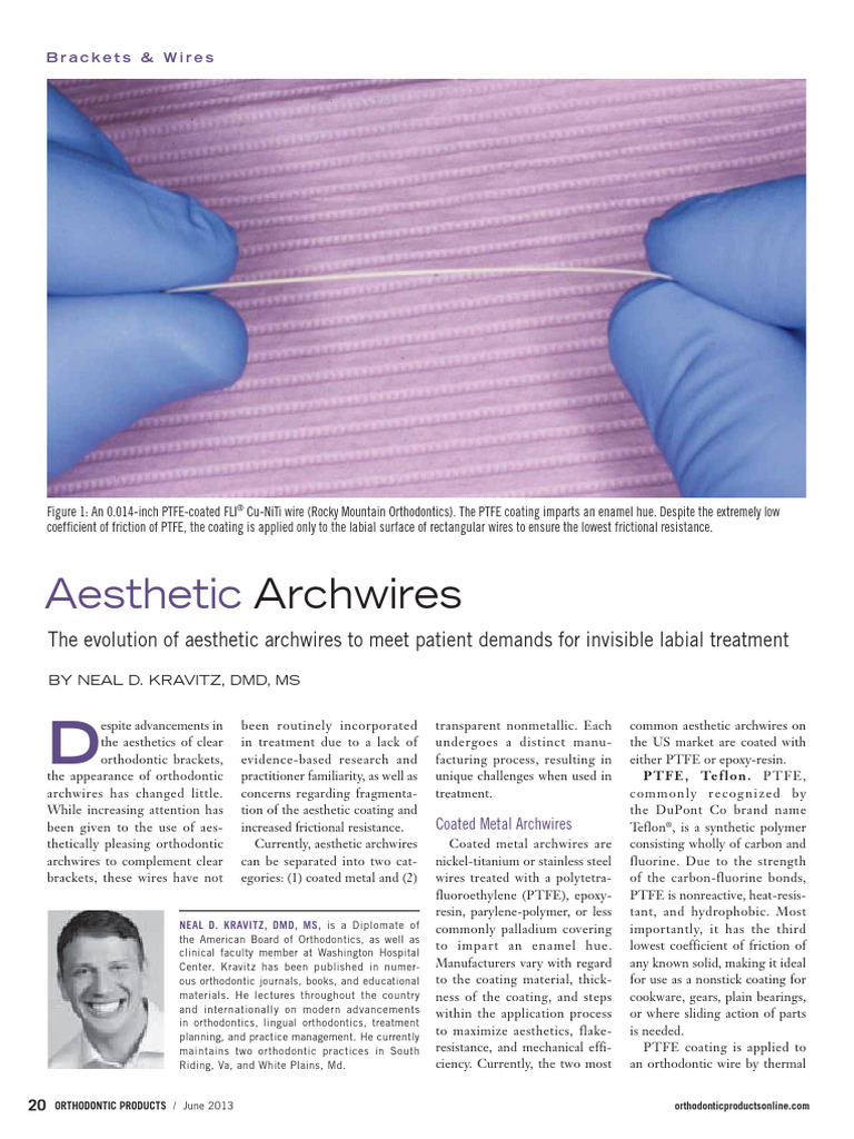 ortho-products-arch-wire-article-dr-kravitz | PDF | Epoxy | Orthodontics