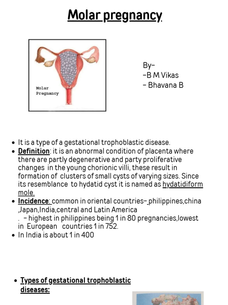 Understanding Molar Pregnancy: Causes & Management | PDF | Diseases And ...