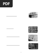 Common Errors in Dental Radiography | PDF