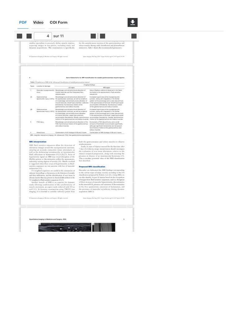 Ultrasound Classification of Gastrocnemius Injuries | PDF | Magnetic ...