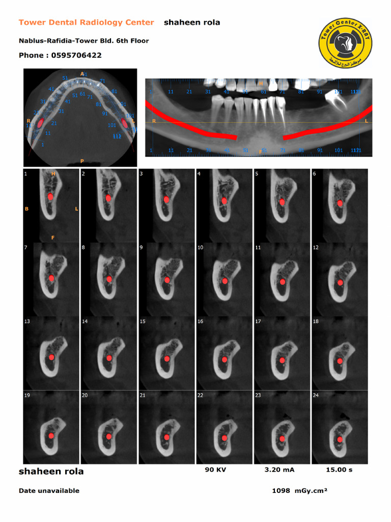 Rola Shaheen - Lower CBCT | PDF