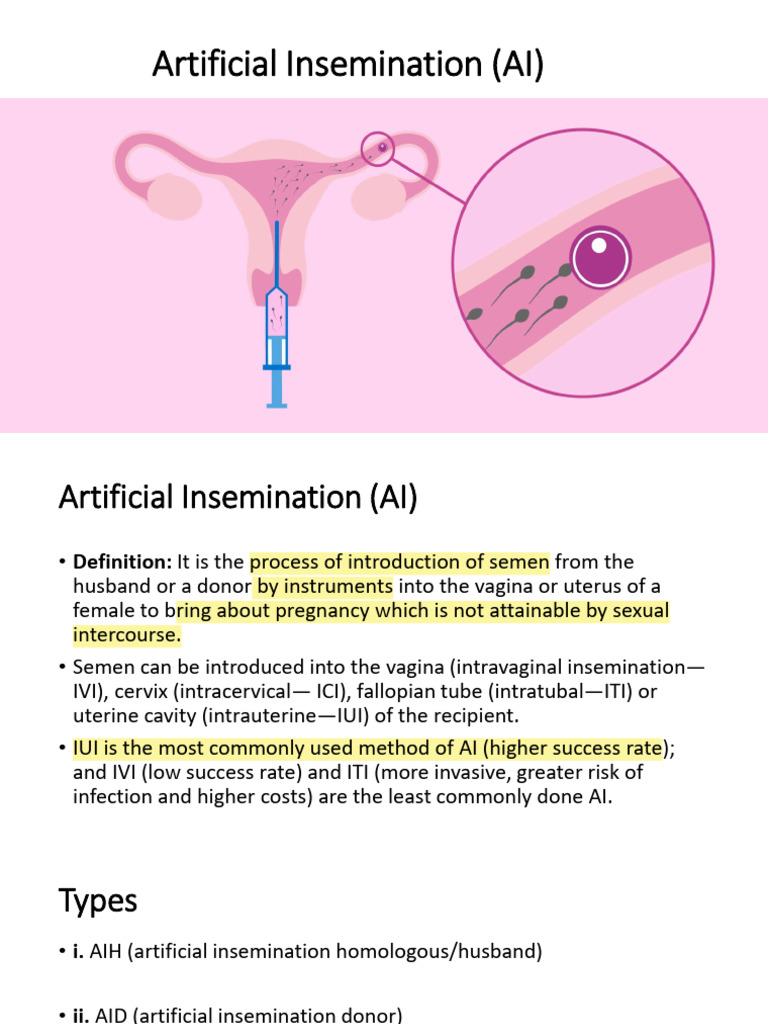 Artificial Insemination | PDF | Surrogacy | Reproduction