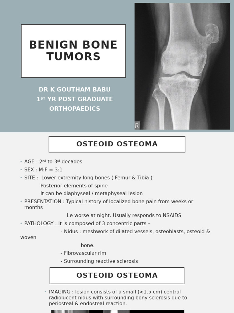 Overview of Benign Bone Tumors | PDF | Musculoskeletal Disorders ...