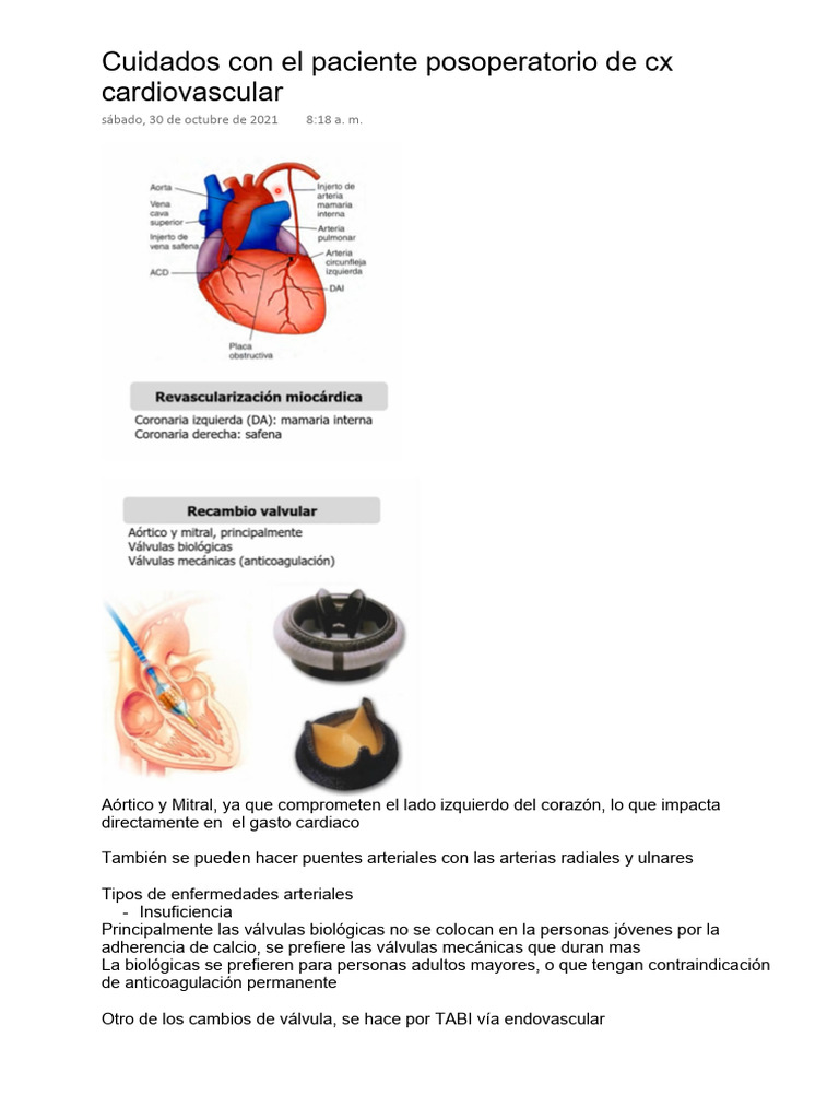 CX Cardiovascular. Ecmo | PDF