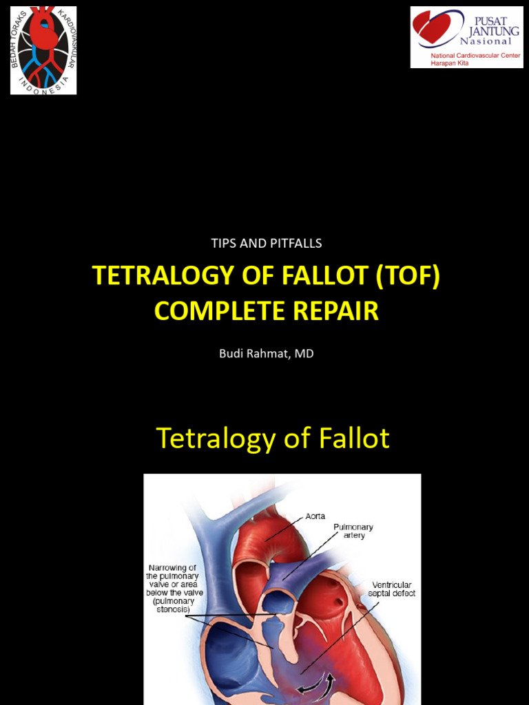 Tips and Pitfall in TOF Repair BR | PDF | Aorta | Clinical Medicine