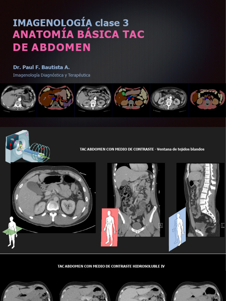 TAC DE ABDOMEN (2) | PDF | Intestino grueso | Hígado