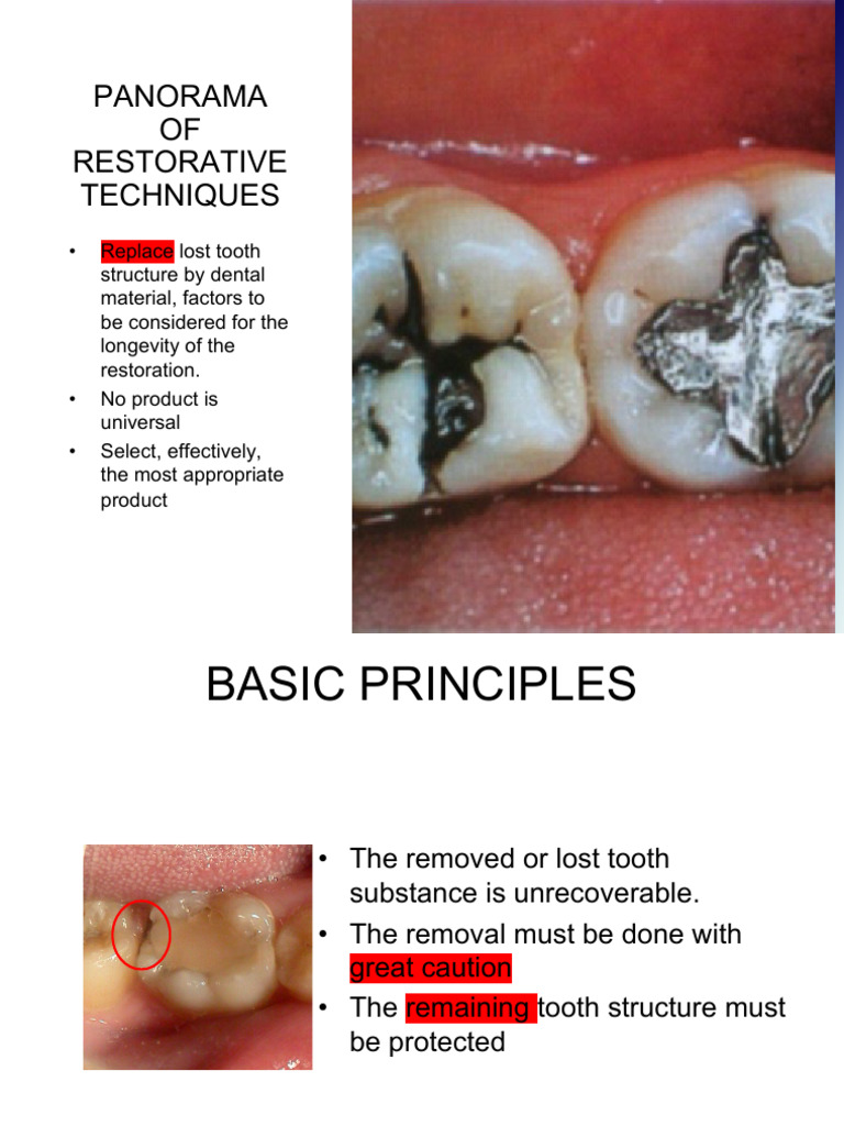 Panorama of Restorative Technique | PDF | Dental Composite | Dentistry ...