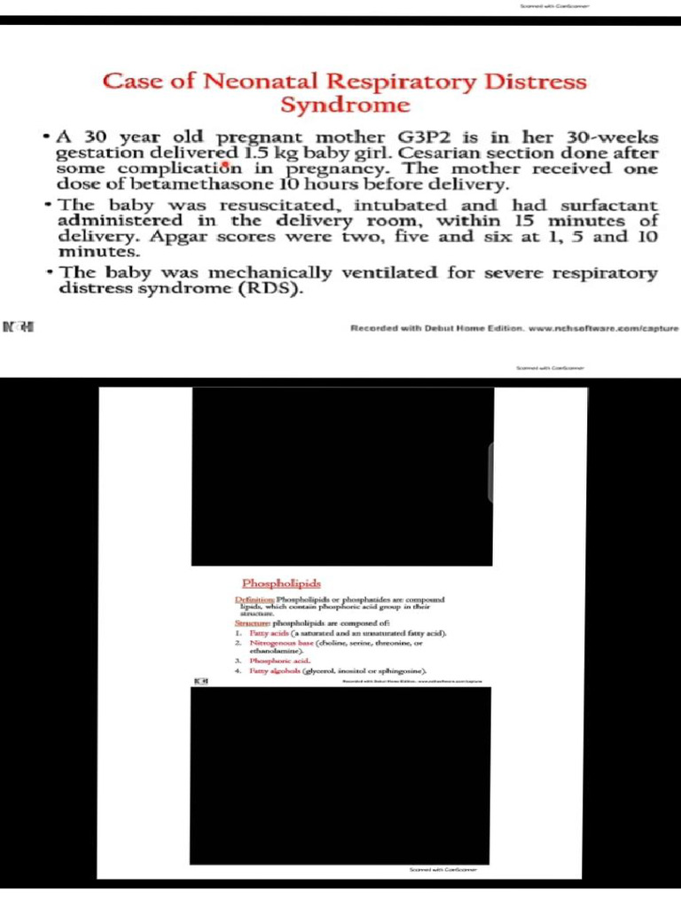 Respo Lectures Clinicals | PDF