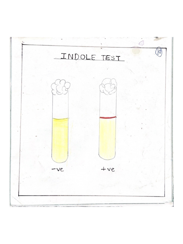 Indole Test | PDF
