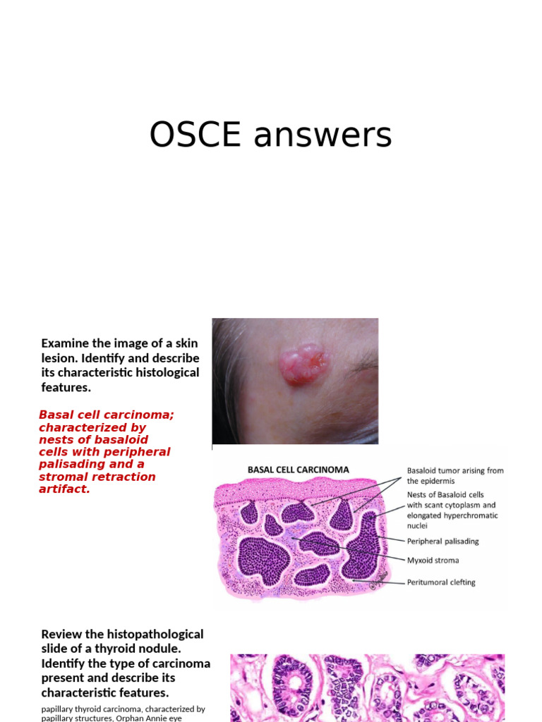 Osce 2 General Surgery | PDF