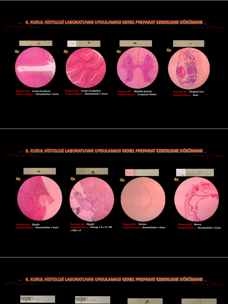 Nöroloji Tüm Histoloji Preparatları Ezberleme Dökümanı | PDF