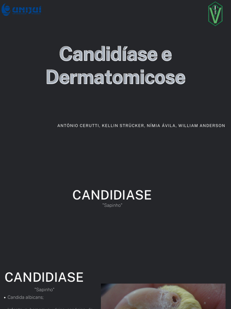 Candidíase e Dermatomicose - 20240620 - 082125 - 0000 | PDF ...
