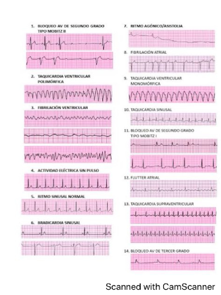 Ritmos Cardíacos ACLS | PDF