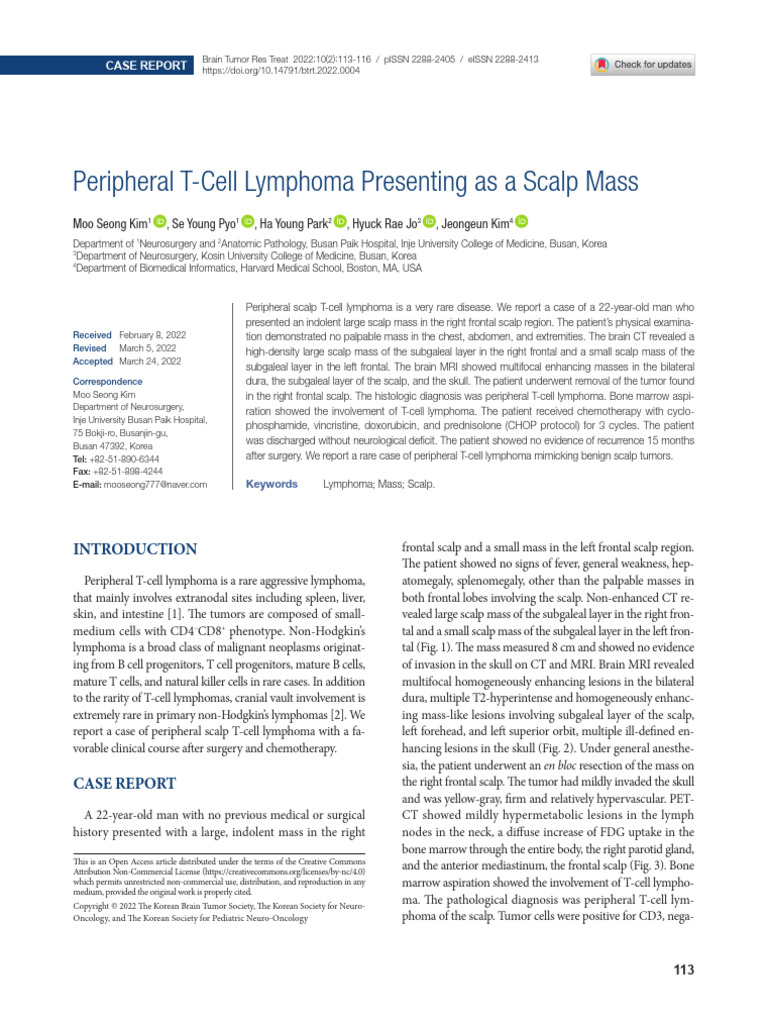 Peripheral T-Cell Lymphoma Presenting As A Scalp M | PDF | Lymphoma | T ...