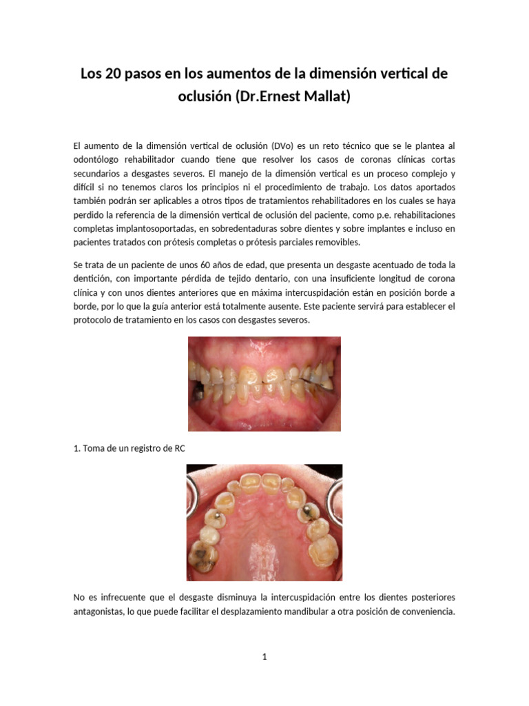 Aumentos de Dimensión Vertical en Oclusión | PDF | Odontología | Ramas ...
