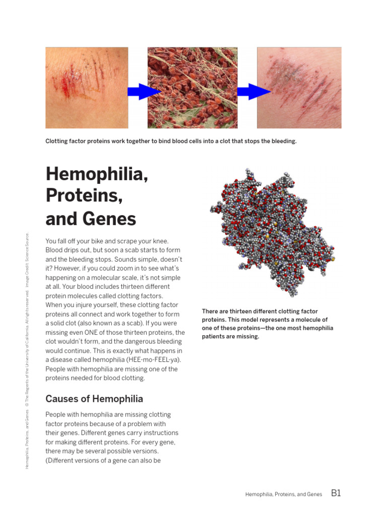 Understanding Hemophilia and Gene Therapy | PDF | Haemophilia | Zygosity