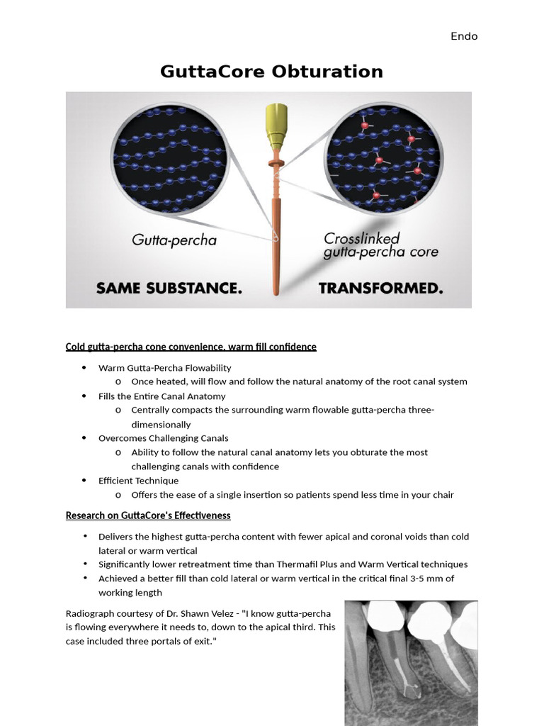 GuttaCore Obturation | PDF
