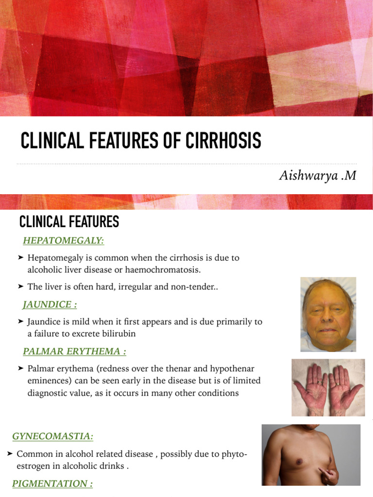 CIRRHOSIS | PDF
