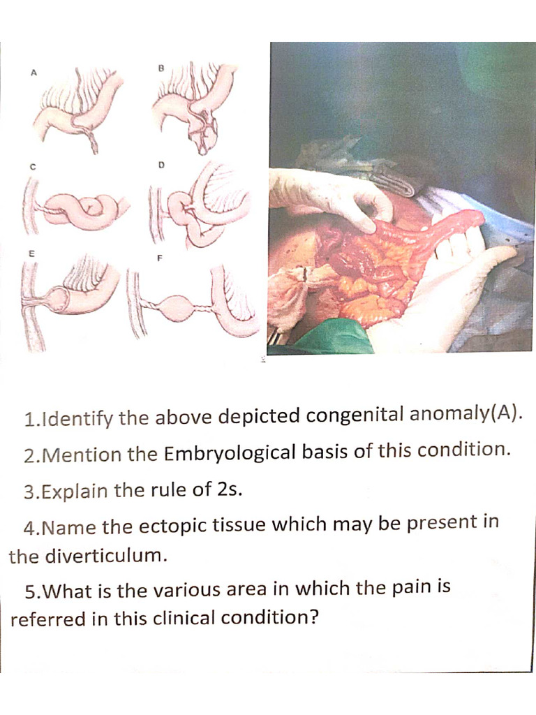 Anatomy All Ospe's | PDF