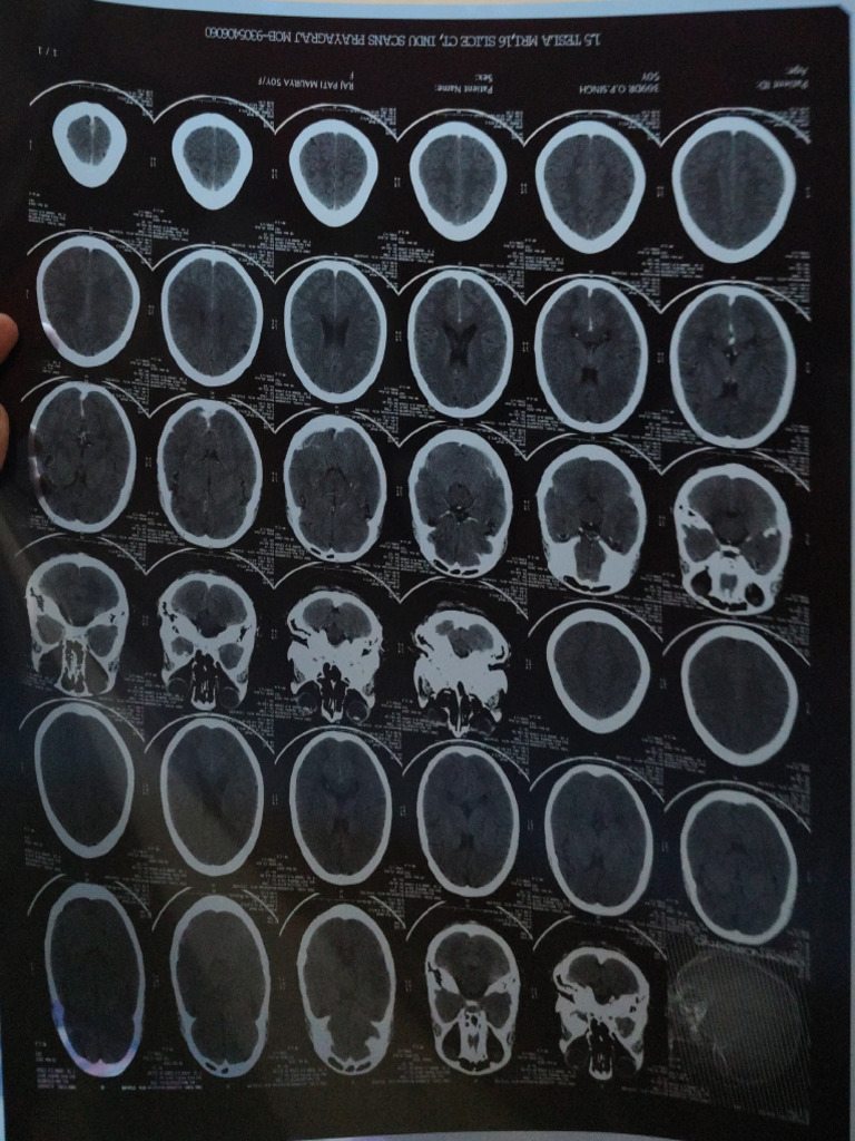 Scan 20241201 190115554 | PDF